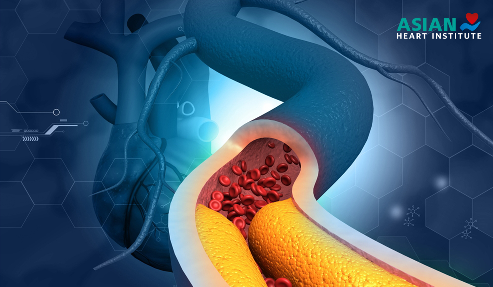 How To Check For Heart Blockage: Top Tests You Should Know About