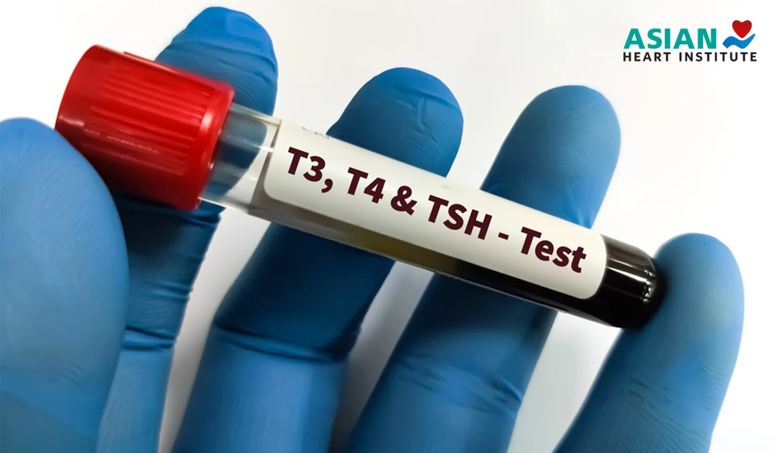 TSH, T3, T4 Normal Range by Age & Gender | Thyroid Test Guide