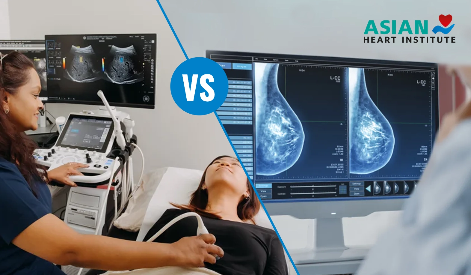 Sonomammography vs Mammography: Which Breast Screening Test is Right ...