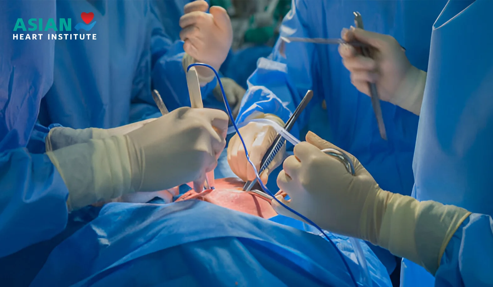 Post-Heart Surgery Recovery: What Patients Need to Know | AHI
