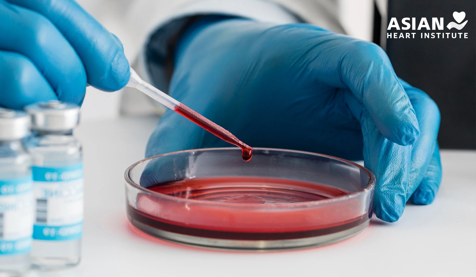 SGPT Test: Meaning, Normal Range & Liver Health Importance